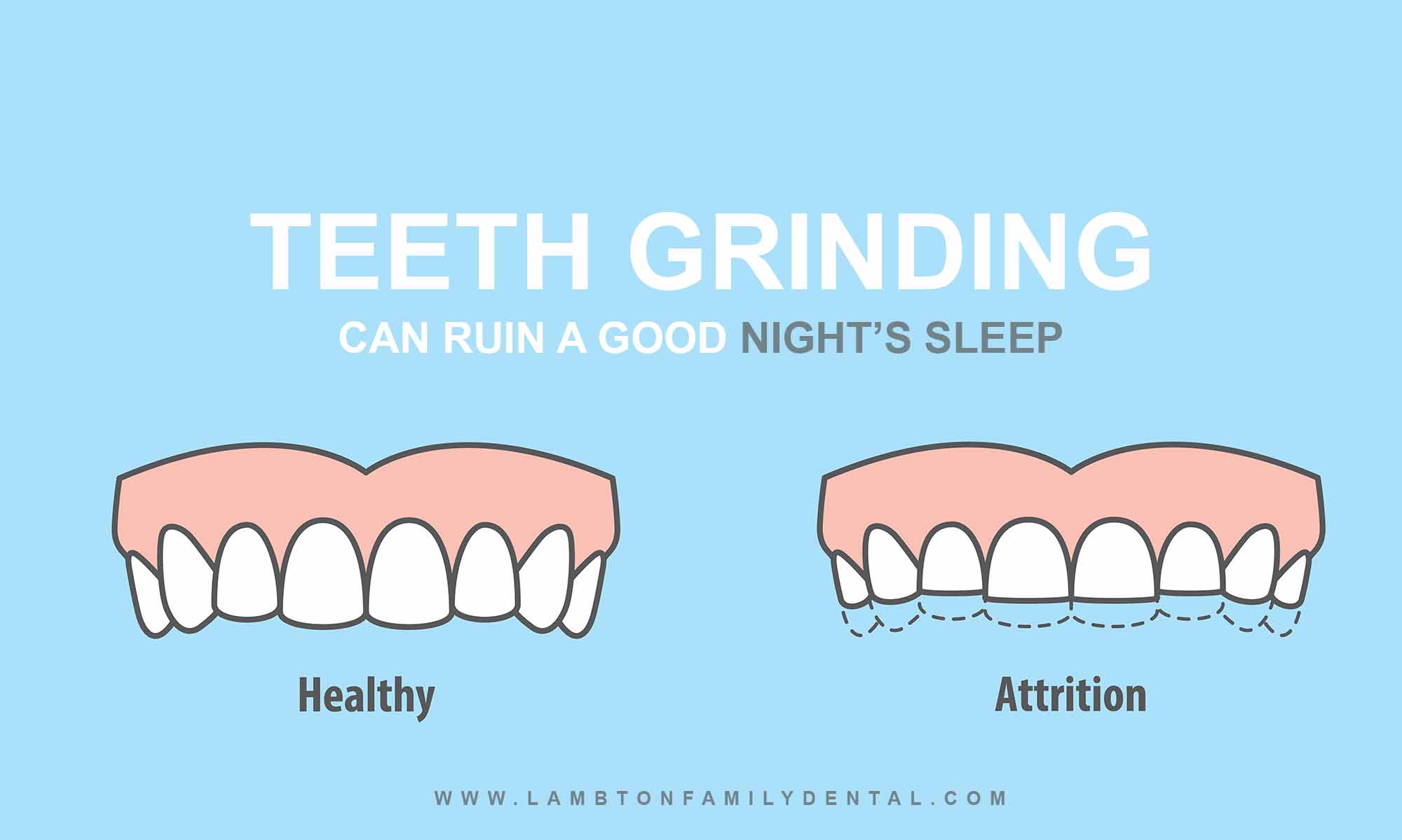 Gnashing Teeth